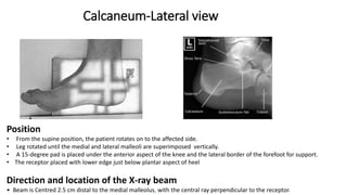 XRAY ANKLE POSITIONING.pptx