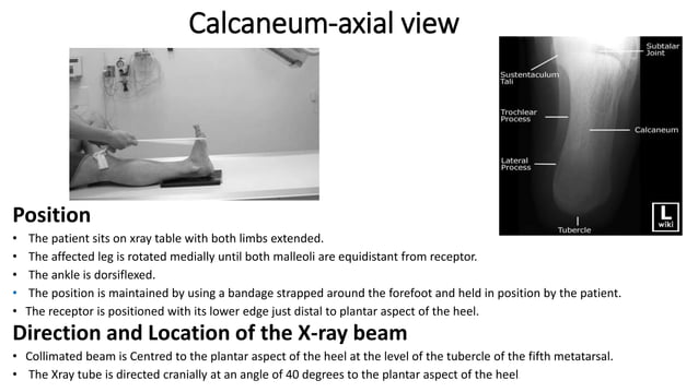 XRAY ANKLE POSITIONING.pptx | Death, Injury, or Military Conflict ...