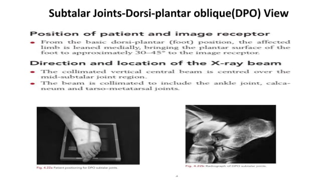 XRAY ANKLE POSITIONING.pptx | Death, Injury, or Military Conflict ...