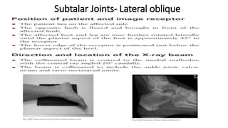 XRAY ANKLE POSITIONING.pptx
