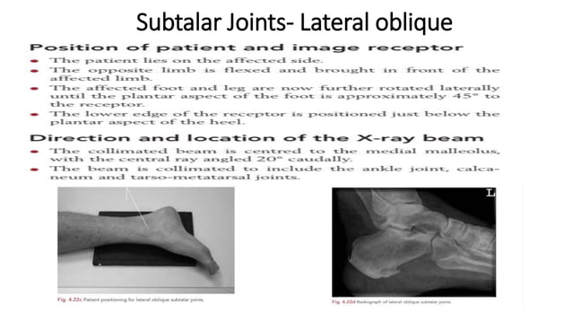 XRAY ANKLE POSITIONING.pptx | Death, Injury, or Military Conflict ...