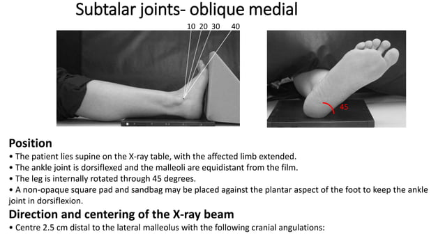 XRAY ANKLE POSITIONING.pptx | Death, Injury, or Military Conflict ...