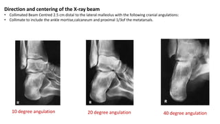 XRAY ANKLE POSITIONING.pptx | Death, Injury, or Military Conflict ...