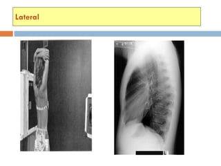 Xray basics by me | PPTX