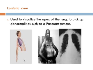 Xray basics by me | PPTX