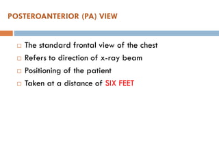 Xray basics by me | PPTX