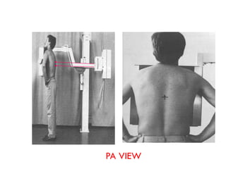 Xray basics by me | PPTX