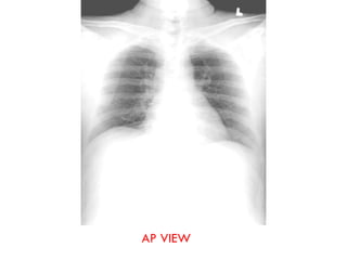 Xray basics by me | PPTX