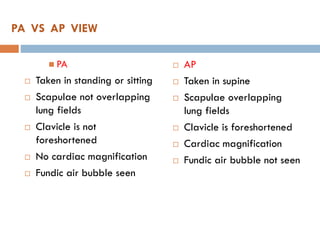 Xray basics by me | PPTX