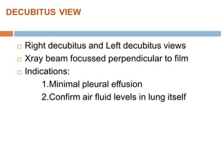 Xray basics by me | PPTX