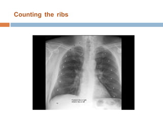 Xray basics by me | PPTX