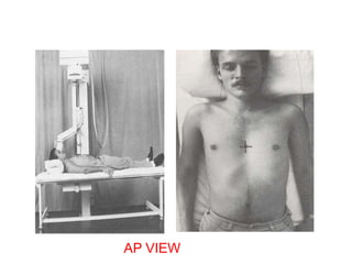 Xray basics by me | PPTX