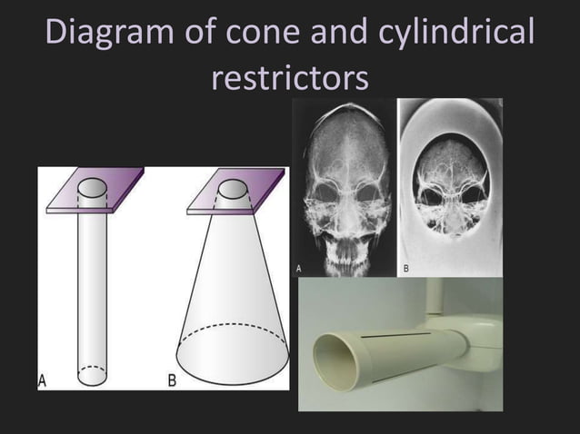 XRAY BEAM RESTRICTORS.pptx