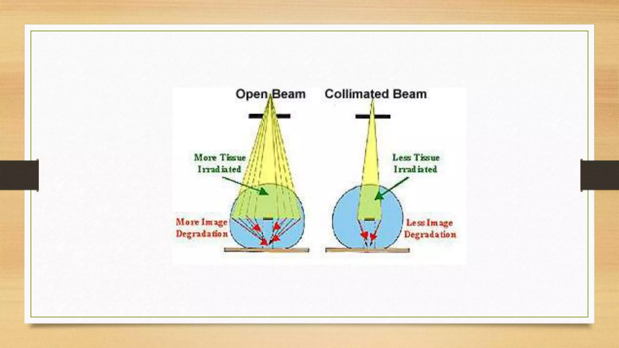 Xray beam restrictors 1436711280968 | PPTX