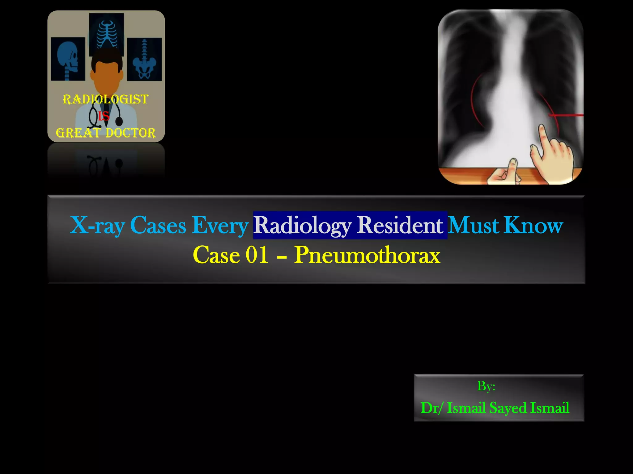 Xray cases radiology residents-must know | PDF