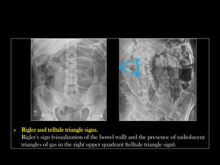 Xray cases radiology residents-must know | PDF