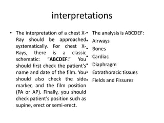 x ray chest.pptx