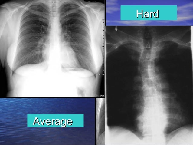 What Does X Ray Mean On Prime What Does X Ray Mean On Prime