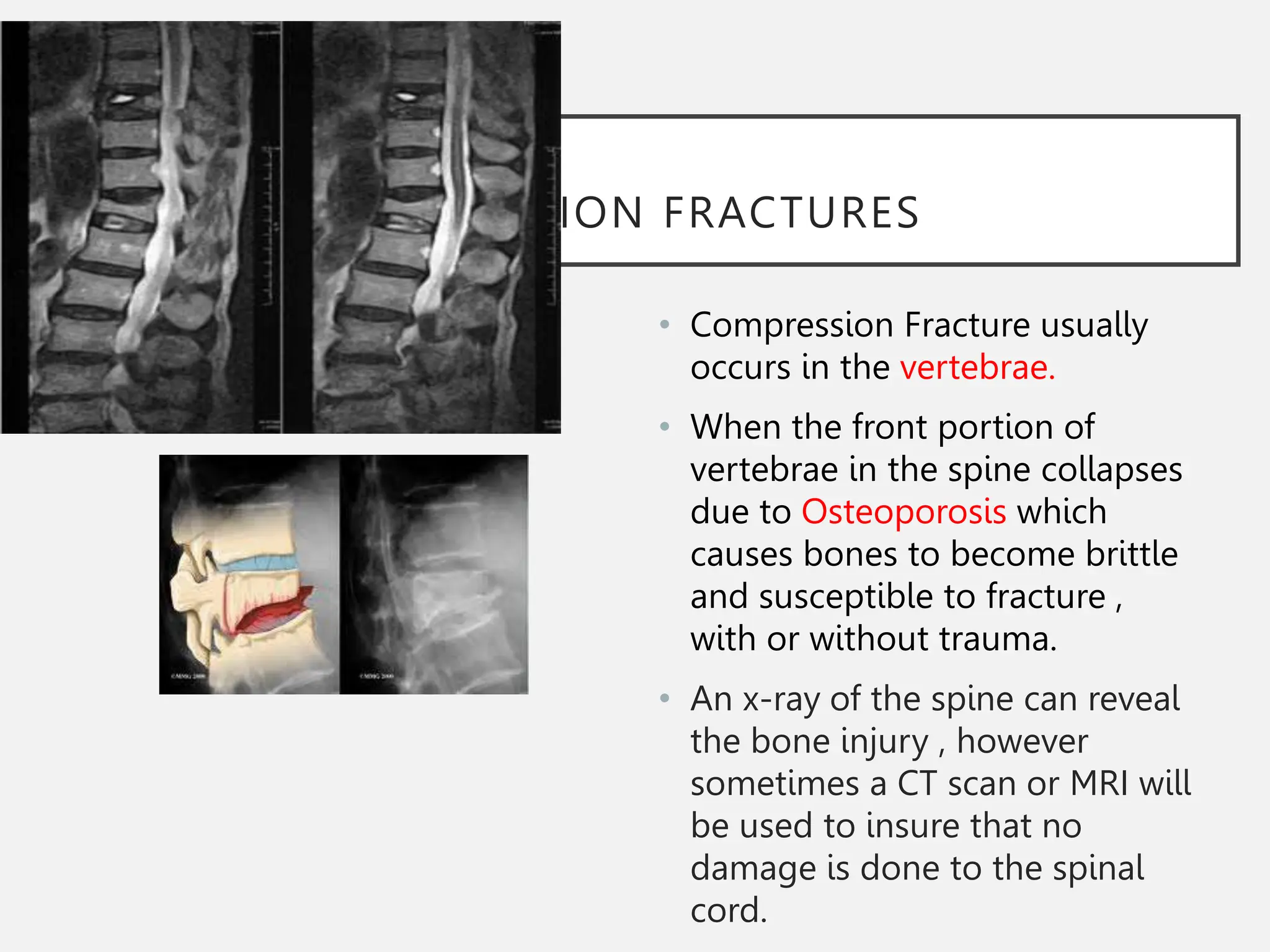 x ray diagnostics of fractures and dislocations.pptx