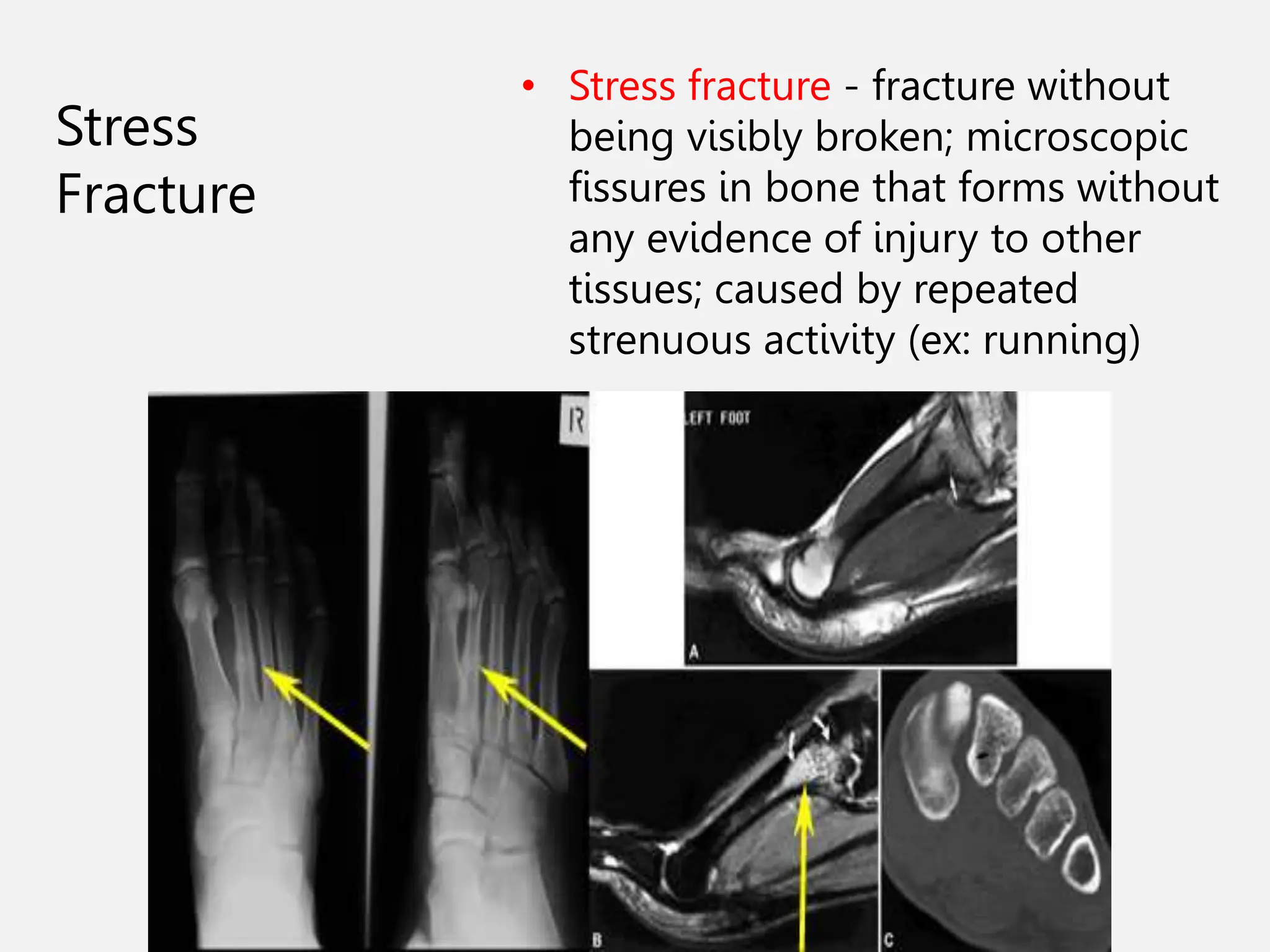 x ray diagnostics of fractures and dislocations.pptx