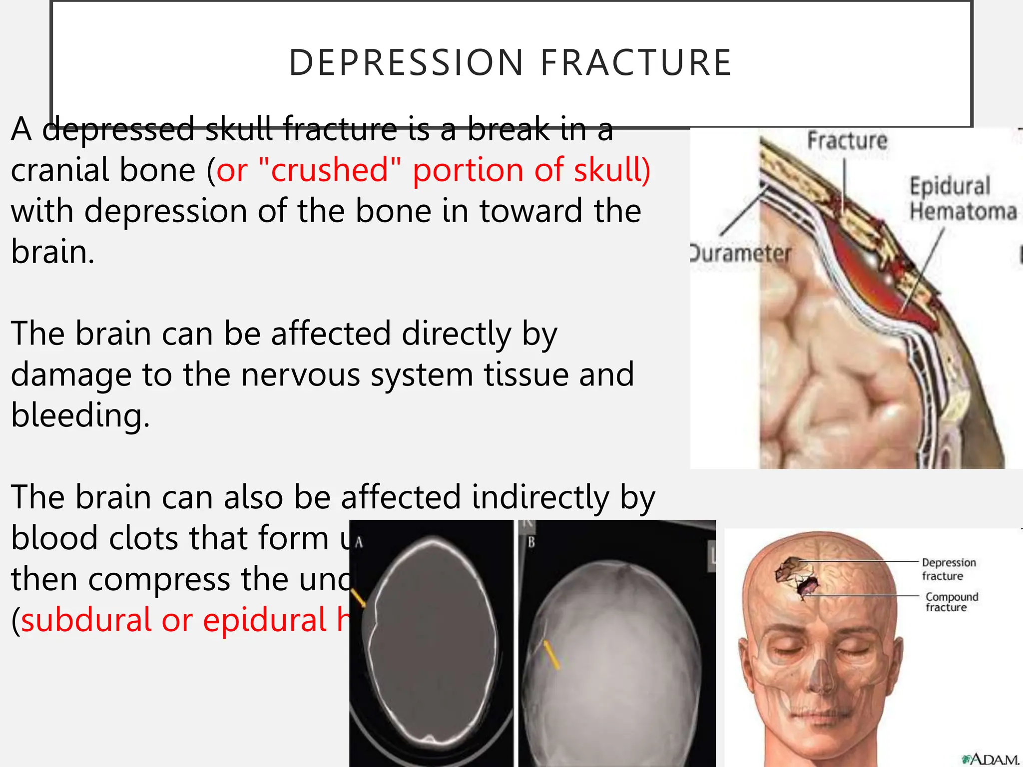 x ray diagnostics of fractures and dislocations.pptx