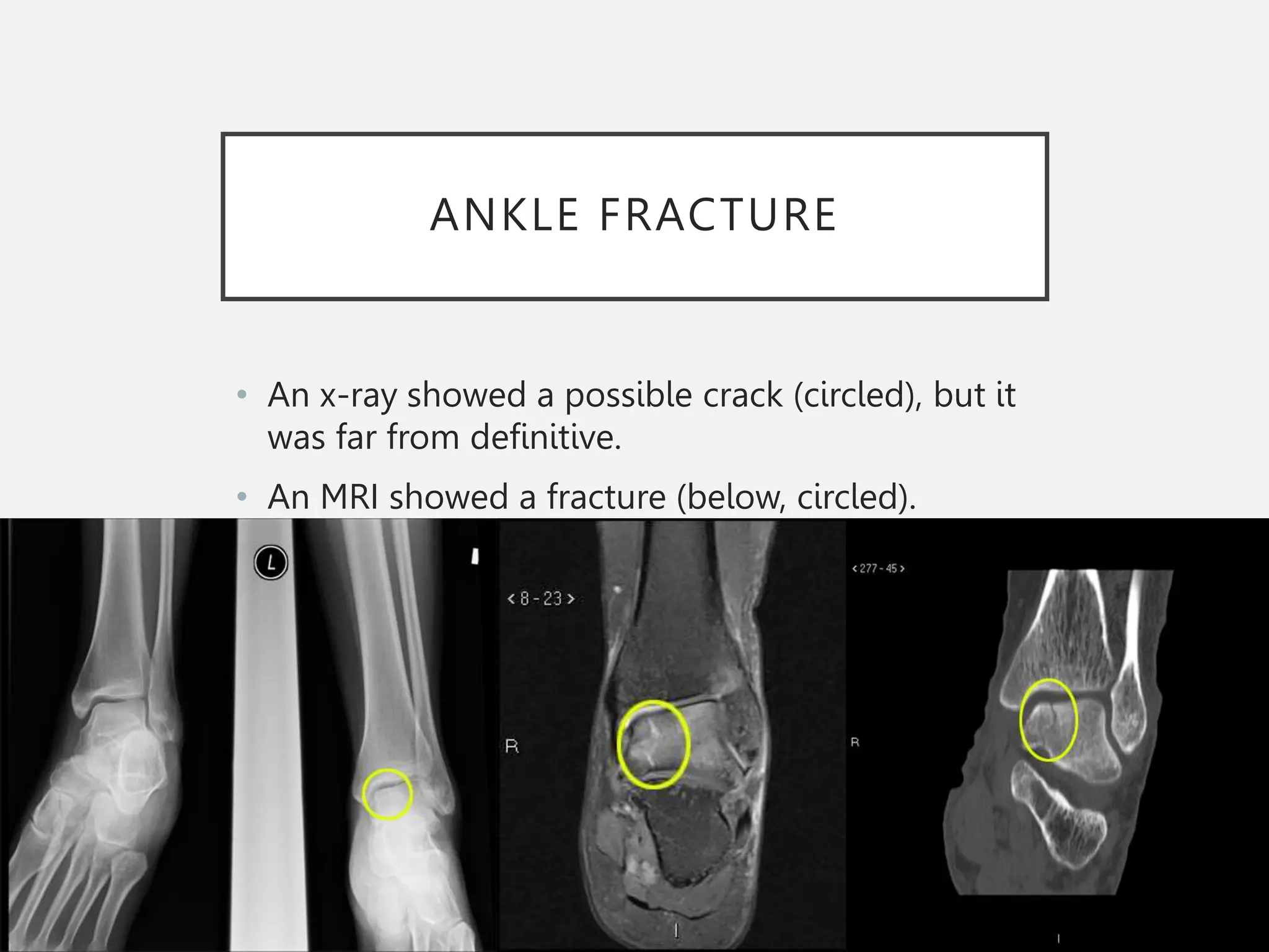x ray diagnostics of fractures and dislocations.pptx