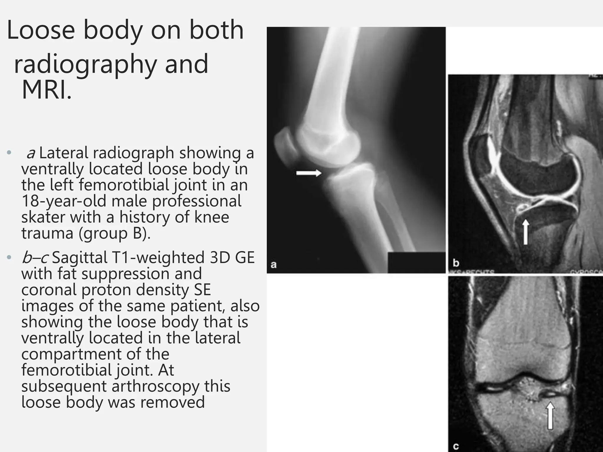 x ray diagnostics of fractures and dislocations.pptx