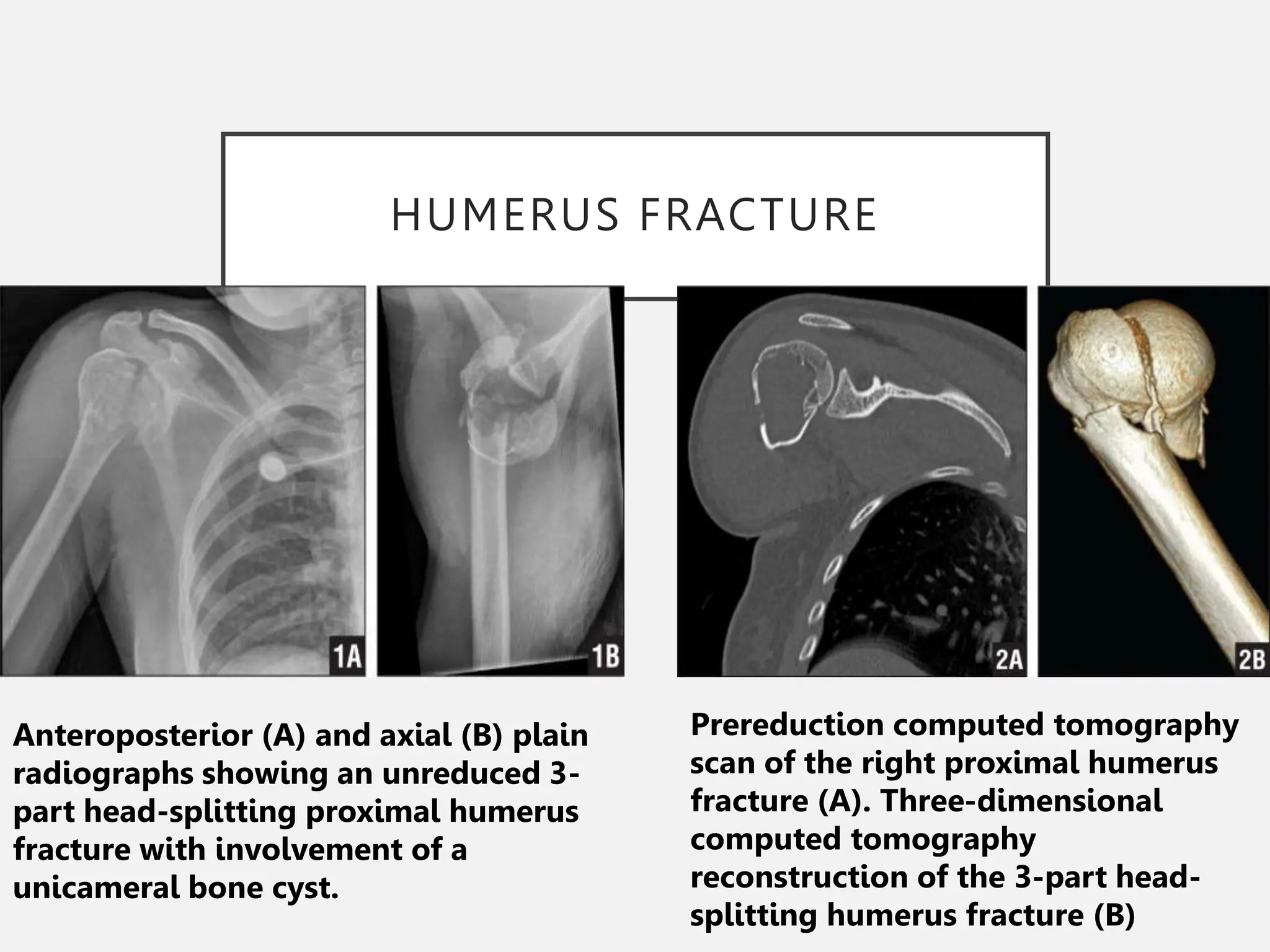 x ray diagnostics of fractures and dislocations.pptx