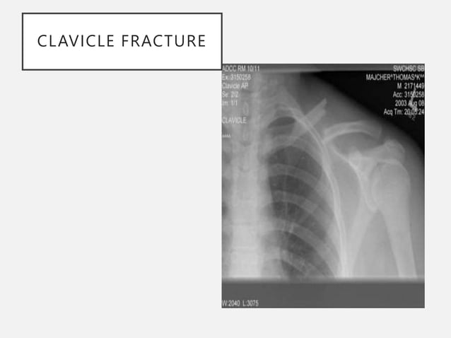 x ray diagnostics of fractures and dislocations.pptx