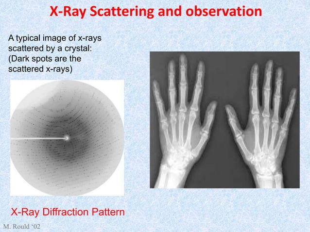 X ray diffraction | PPT