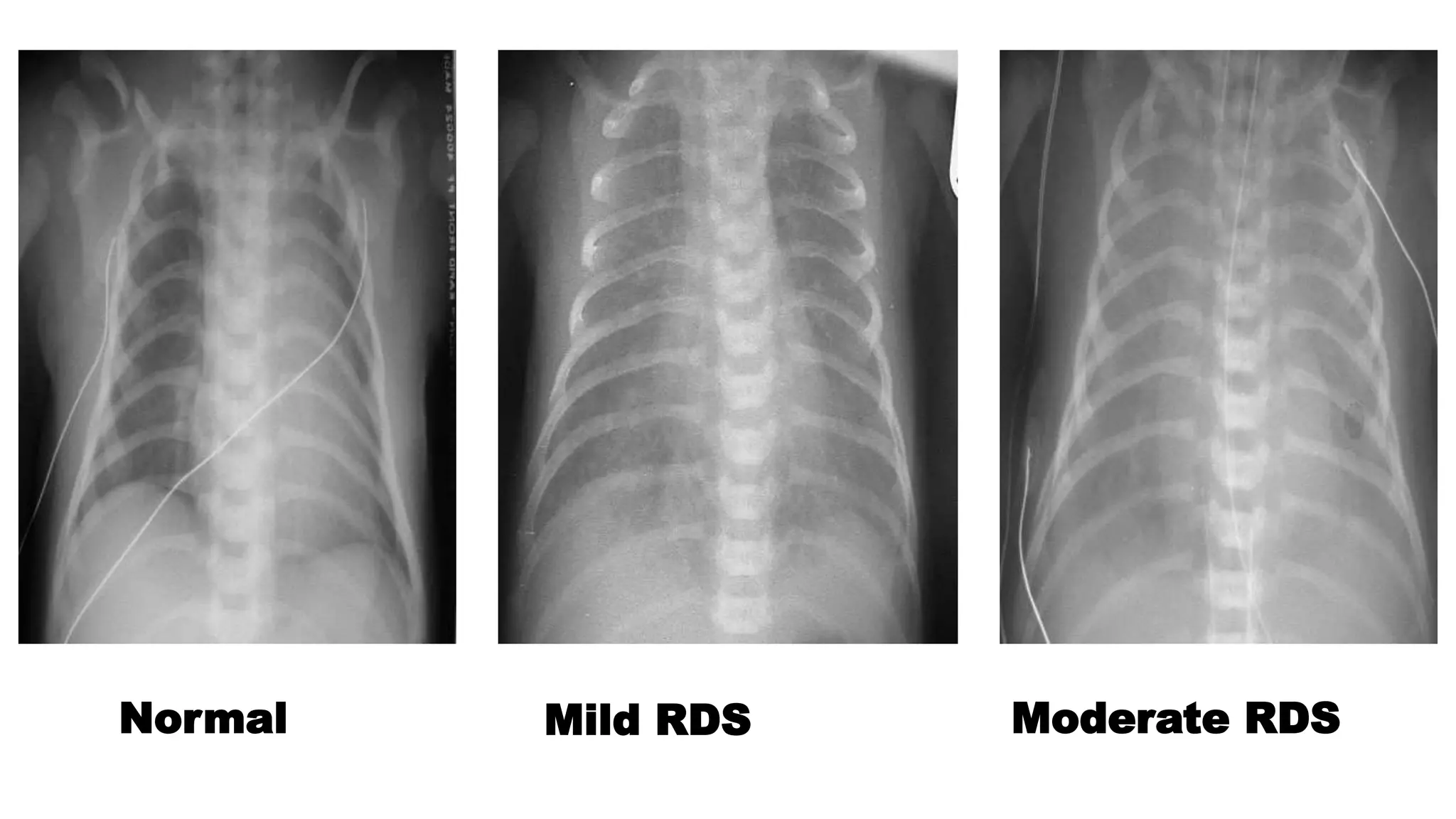 X ray Dr Marwa | PPSX