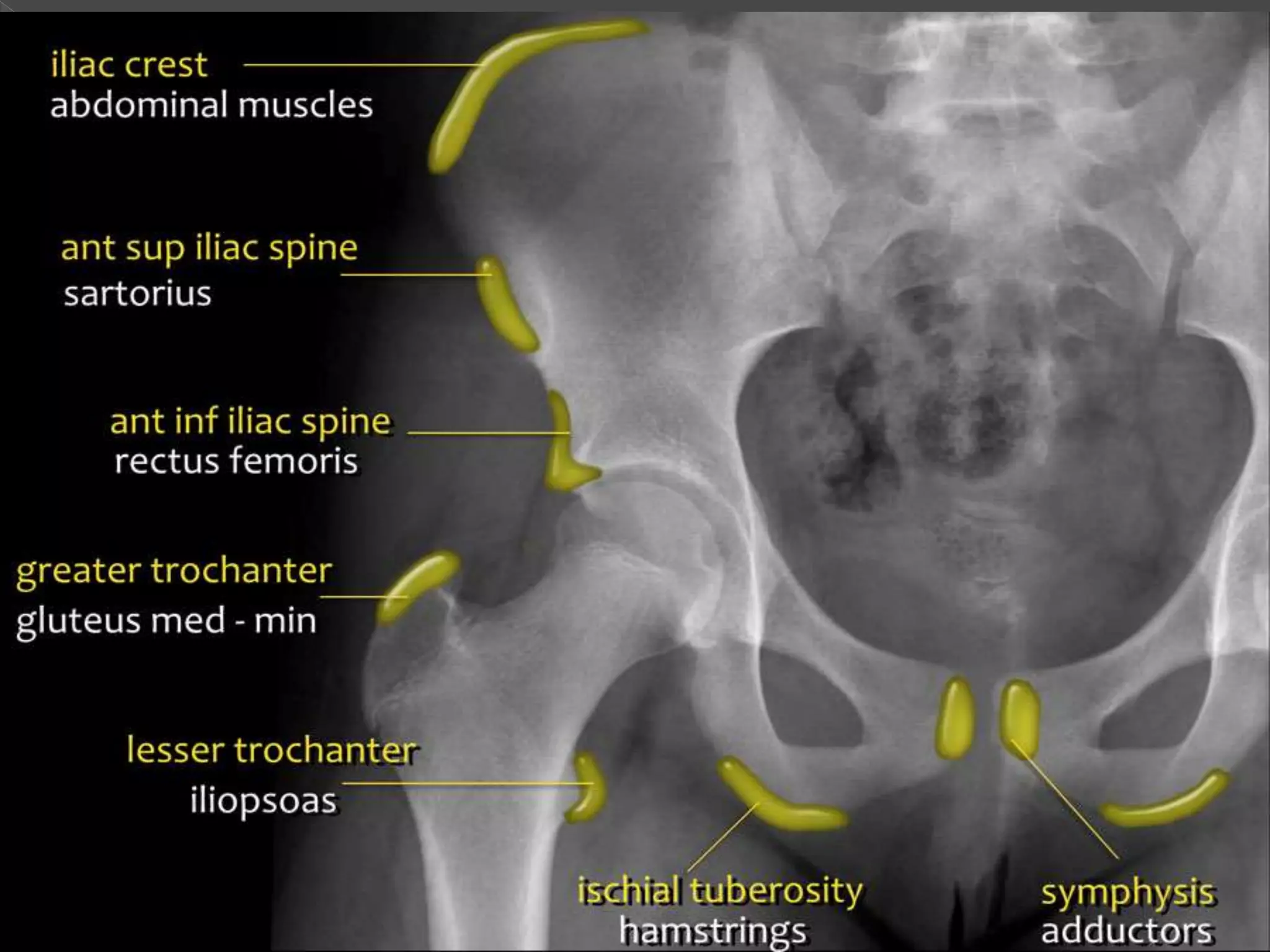 X-ray examination for determination of Age | PPTX