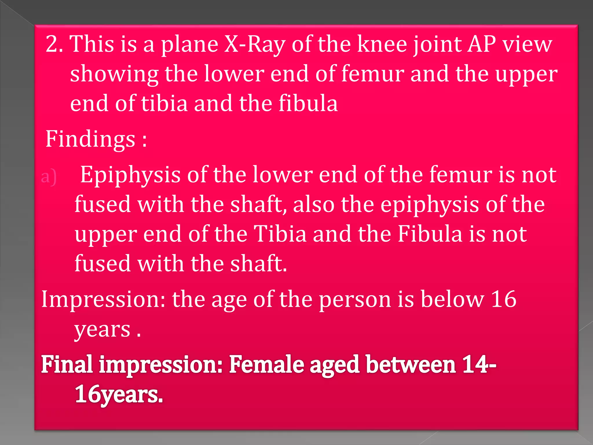 X-ray examination for determination of Age | PPTX