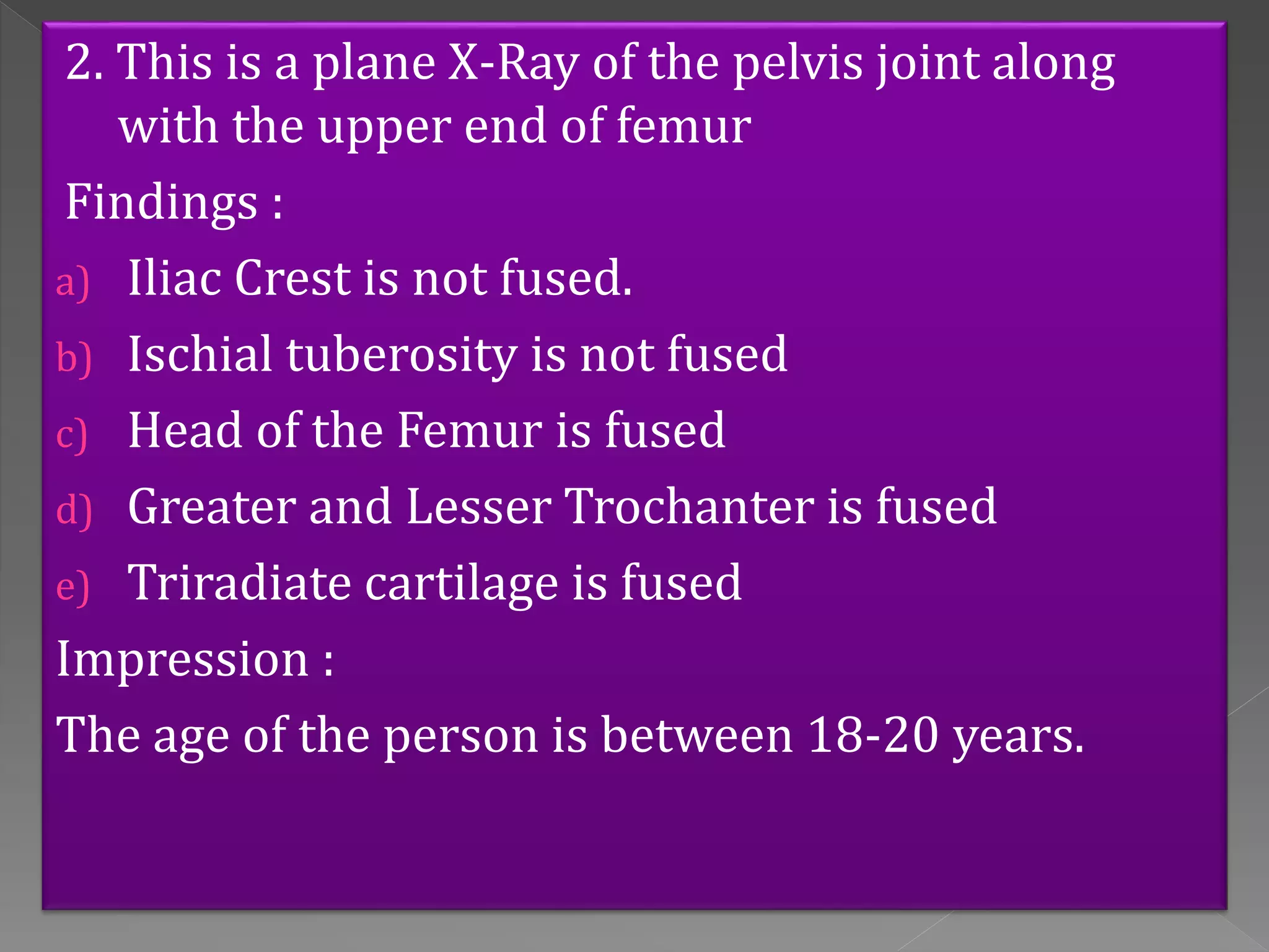X-ray examination for determination of Age | PPTX