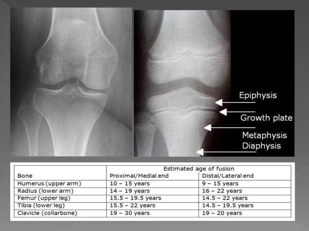 X-ray examination for determination of Age