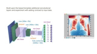 X ray Image Classification | PPTX