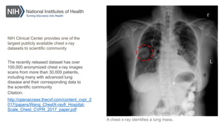 X ray Image Classification | PPTX