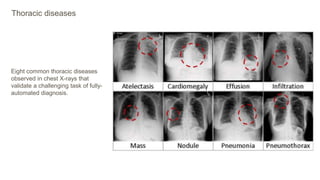 X ray Image Classification | PPTX