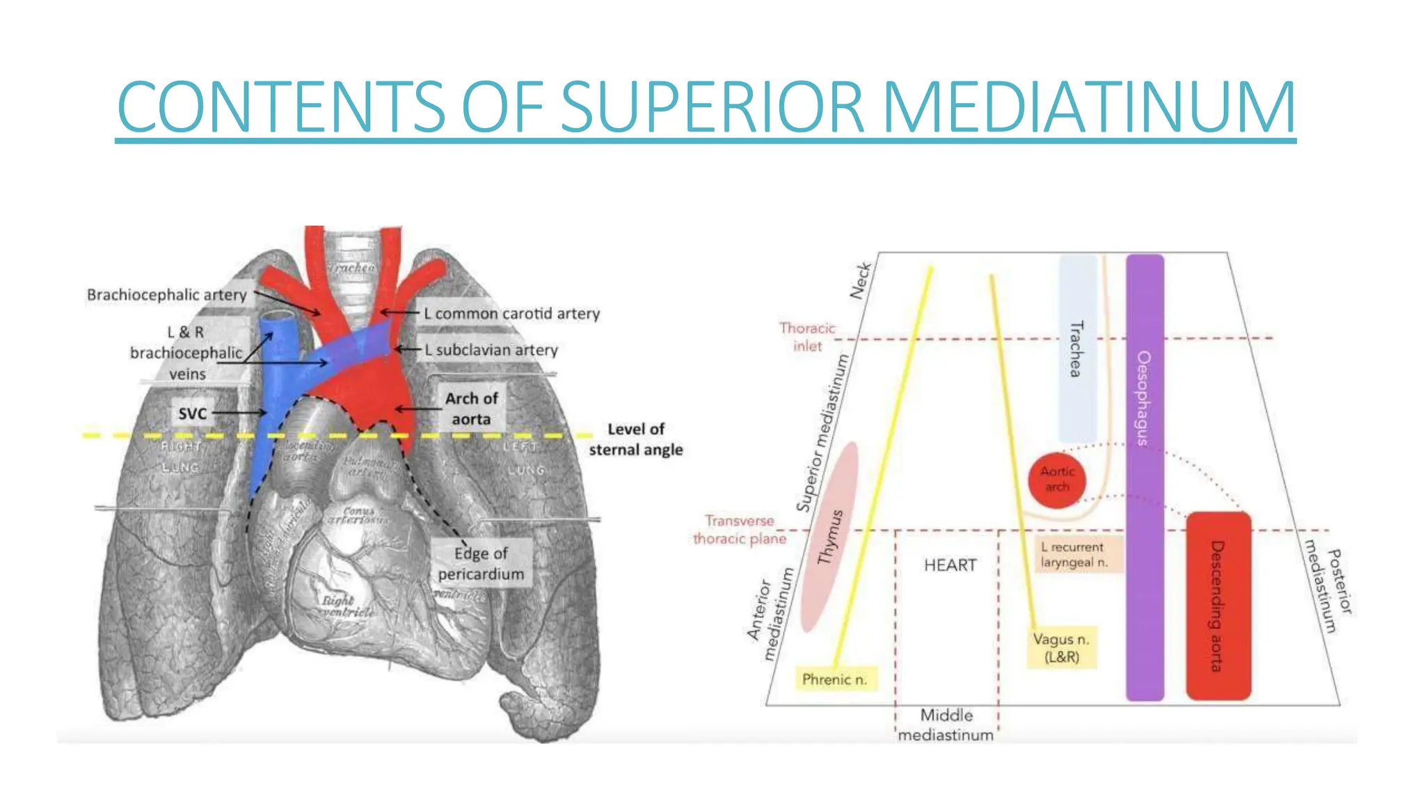 radio anatomy of meidastinum and approach to mediastinal masses.pptx