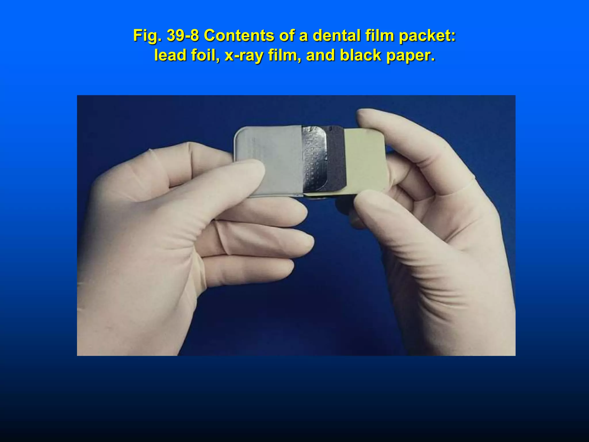 xray films.ppt