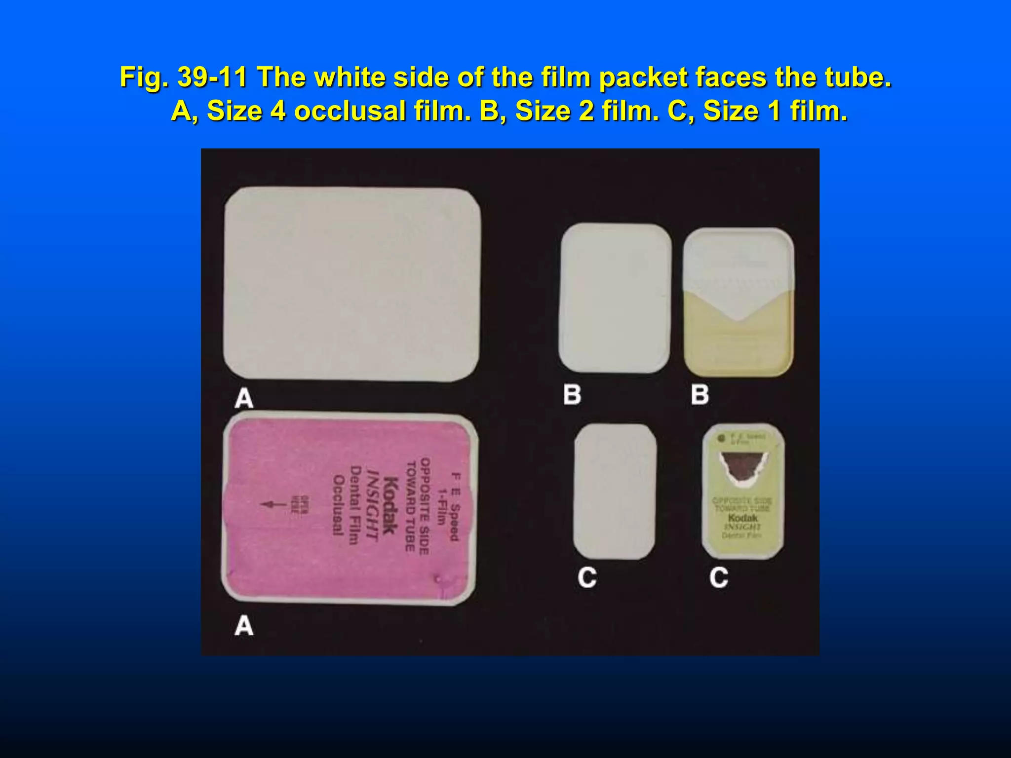 xray films.ppt | Dental Health | Diseases and Conditions