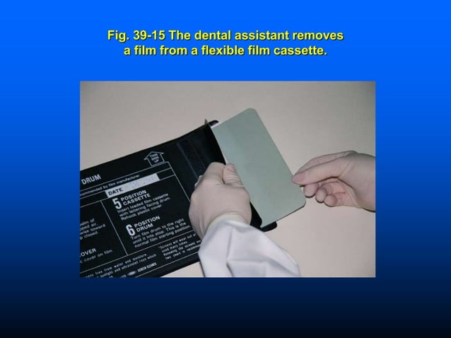 xray films.ppt | Dental Health | Diseases and Conditions