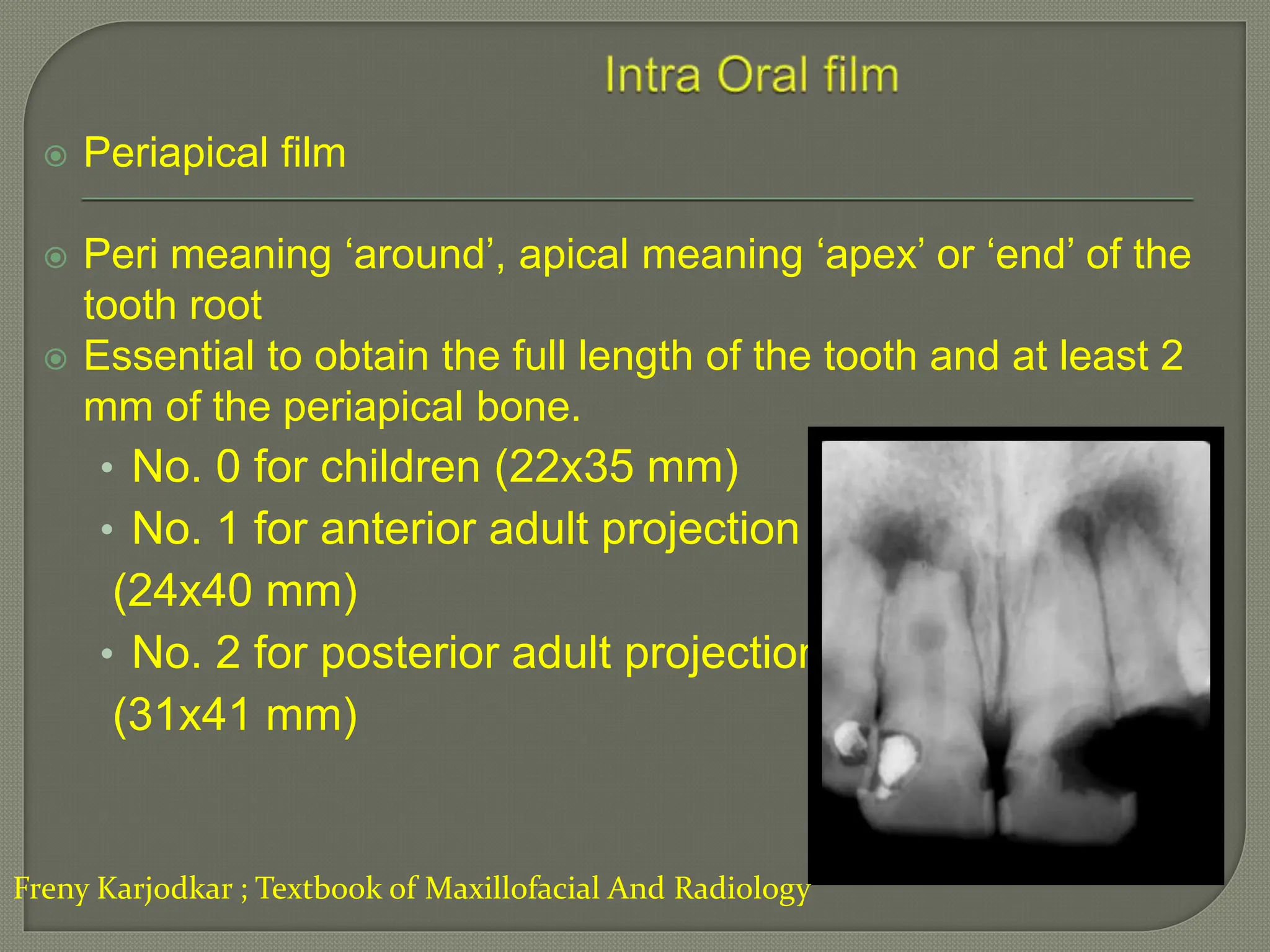X ray films.pptxThe system measure deflection of a laser beam from a ...