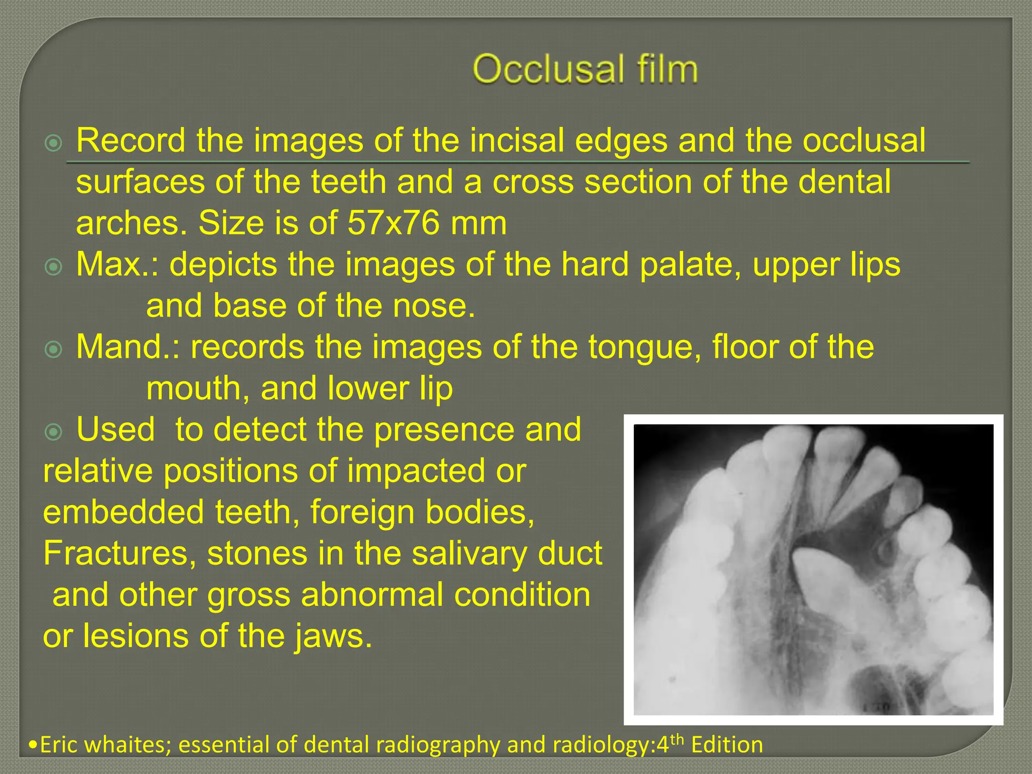 X ray films.pptxThe system measure deflection of a laser beam from a ...