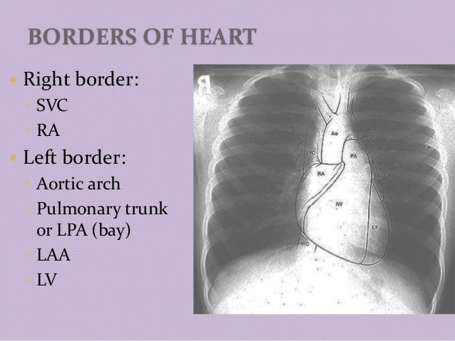 chest radiology in cardiovascular disease