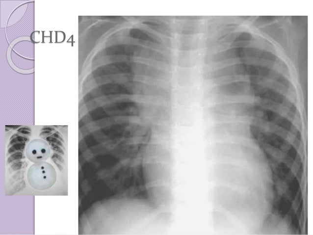 chest radiology in cardiovascular disease