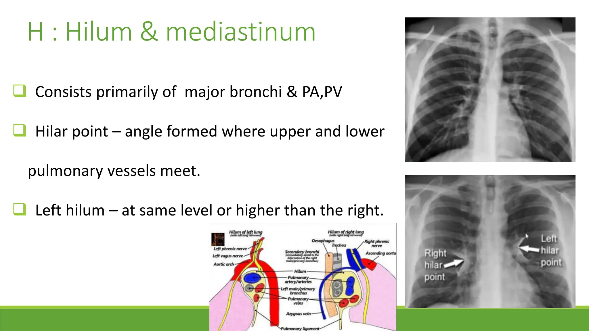 x ray approach for pediatrics and diagnosis | PPTX
