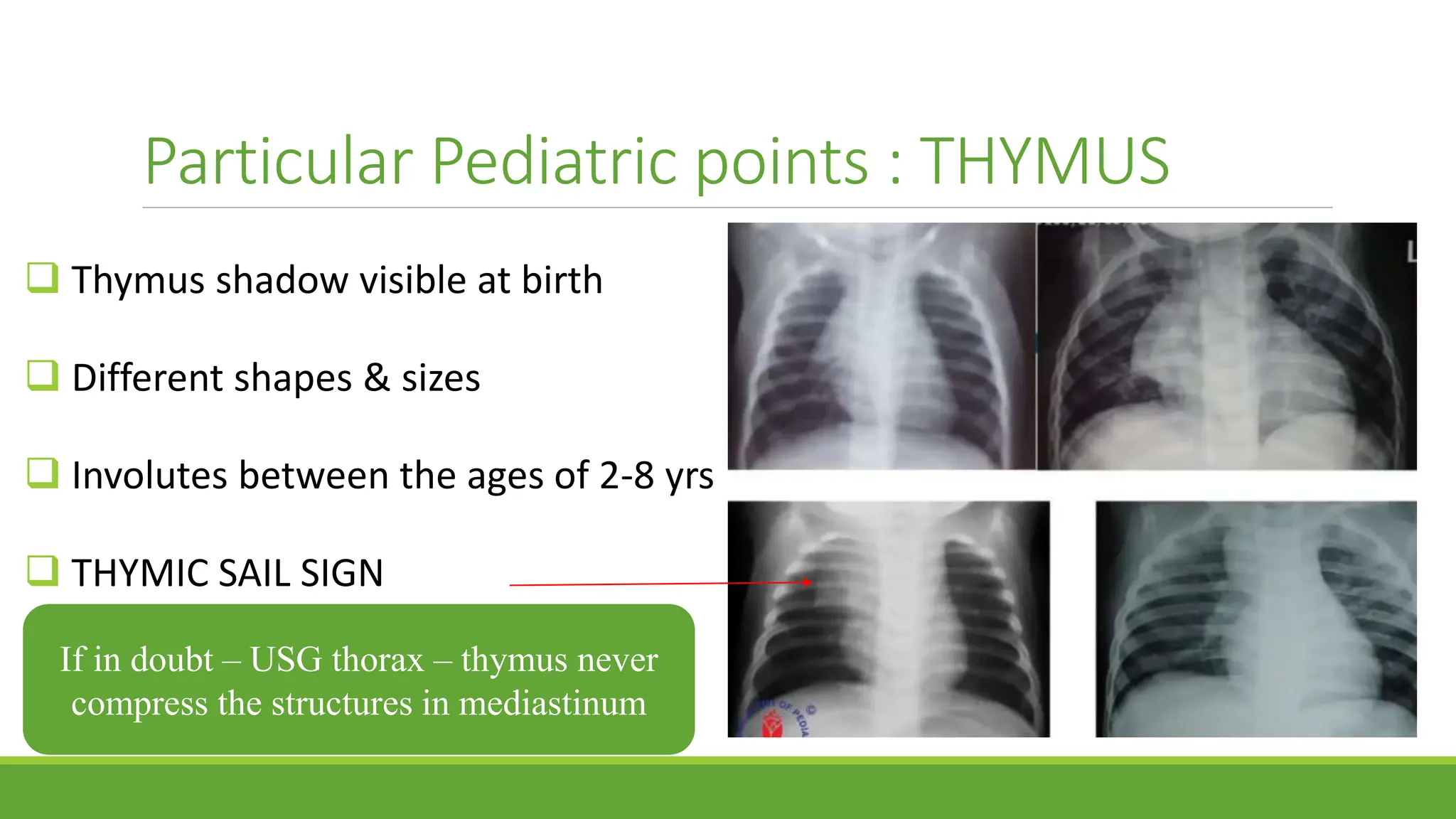 x ray approach for pediatrics and diagnosis | PPTX