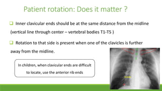 x ray approach for pediatrics and diagnosis | PPTX