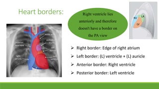 x ray approach for pediatrics and diagnosis | PPTX